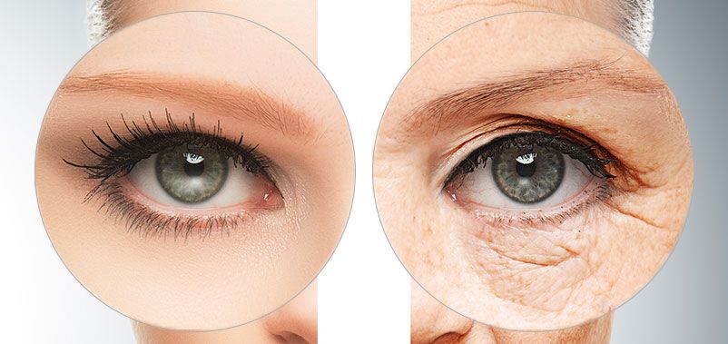 ΜΕΘΟΔΟΣ ABLASE - Derma Laser & Υγεία - Χρήστος Ρέμπελος - Αννα Μαρία ...